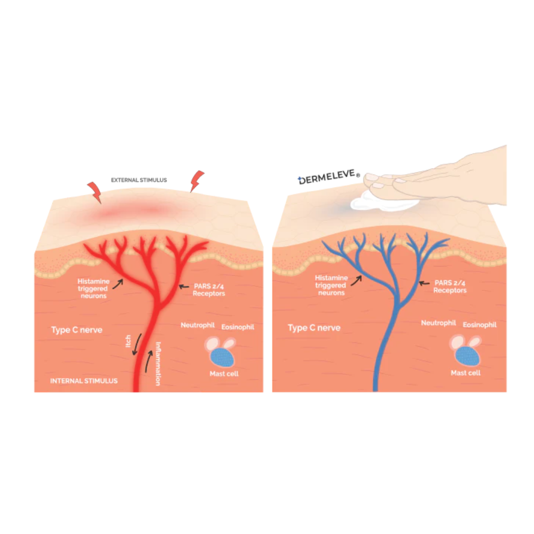 Dermeleve Advanced Formula Soothing Cream
